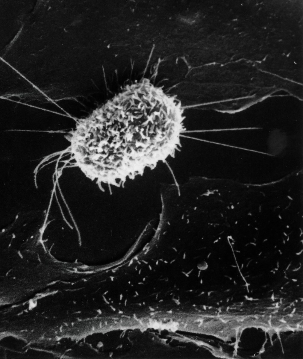 parásitos – estherraezescribe